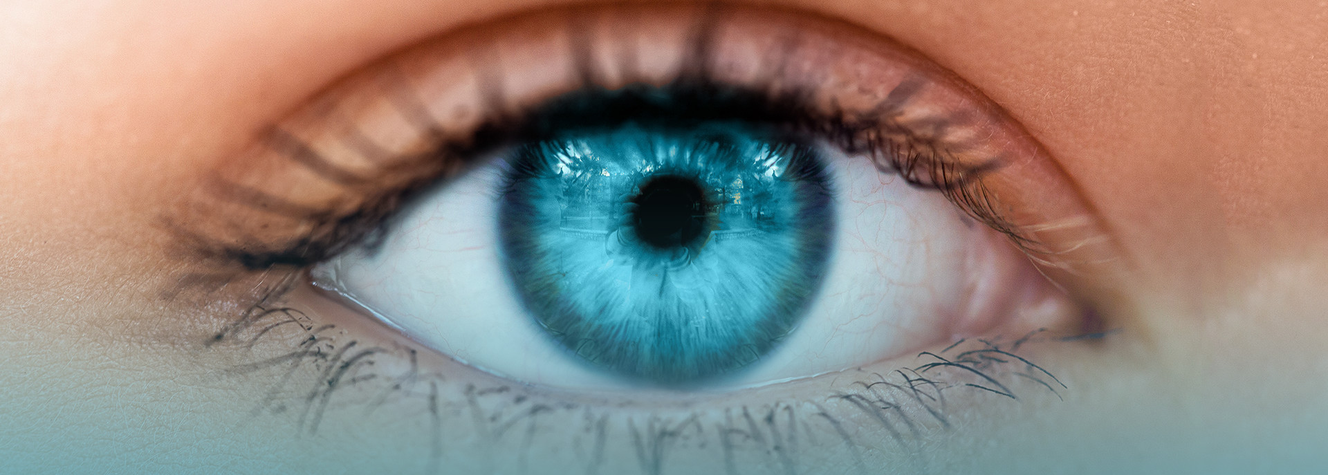 Eye Condition Eye Condition